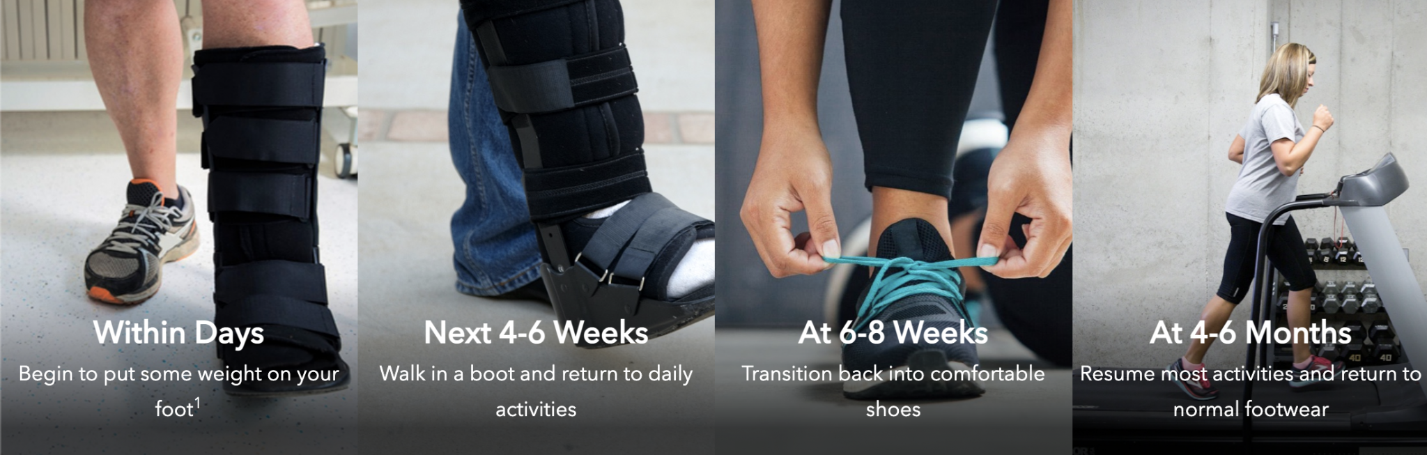 LAPIPLASTY® 3D BUNION SURGICAL REPAIR | Rocky Mountain Orthopedics of Utah